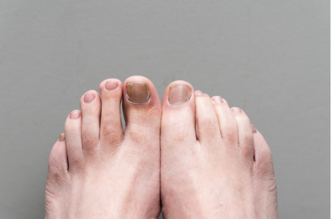 Foot Rot. How To Stop It? Do You Know? | C3A